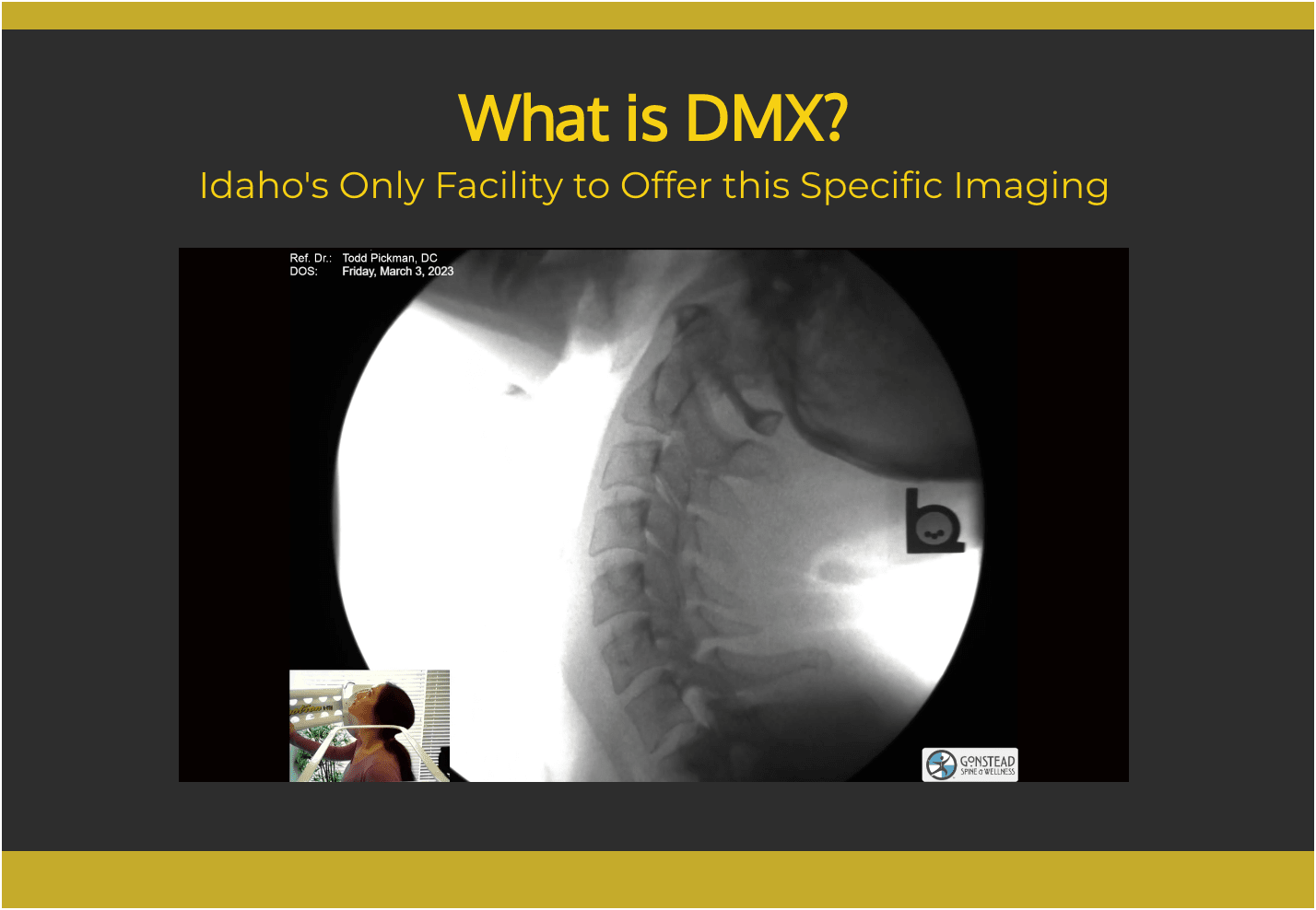 Digital Motion X-Ray